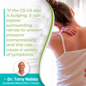 C5-C6 Disc Bulging: Cause, Symptoms, & Treatment Options