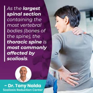 Levoconvex Scoliosis: What It Is, Causes, and Treatment
