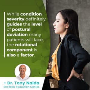 Scoliosis & Rib Hump: Causes, Pain, & Treatment Options