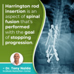 Harrington Rod for Scoliosis: Complications, Surgery, & More