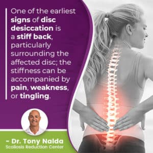 What Is Disc Desiccation? Causes, Symptoms, and Treatment