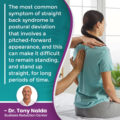 Straight Back Syndrome: What Is It, Symptoms, and Treatment