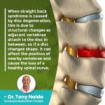 Straight Back Syndrome: What Is It, Symptoms, and Treatment