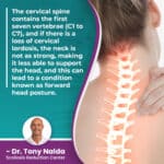 Cervical Curvature Of The Spine: Symptoms & Treatment