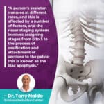 The Risser Stages Classification & Scoliosis Surgery