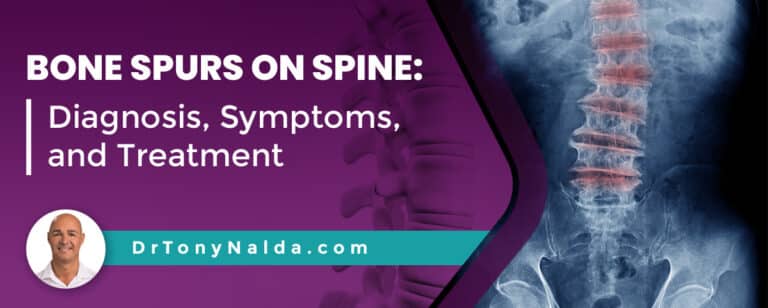 Bone Spurs On Spine: Diagnosis, Symptoms, and Treatment