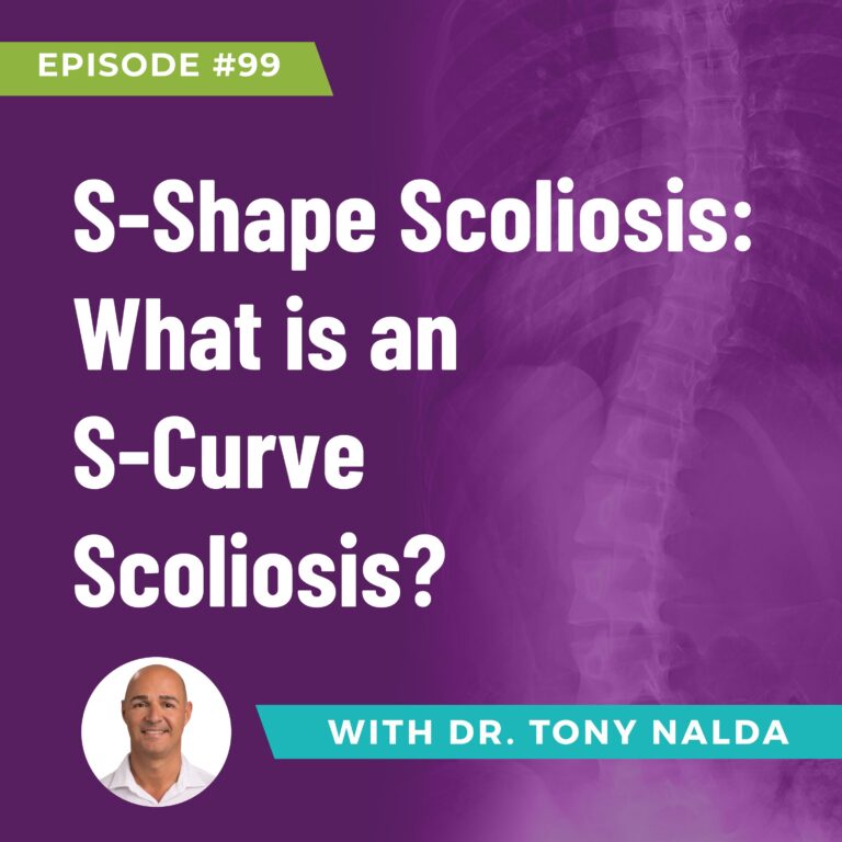 Episode 99: S-Shape Scoliosis: What is an S-Curve Scoliosis?