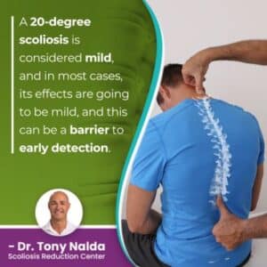 Scoliosis 20 Degrees: Understanding The Degrees Of Scoliosis