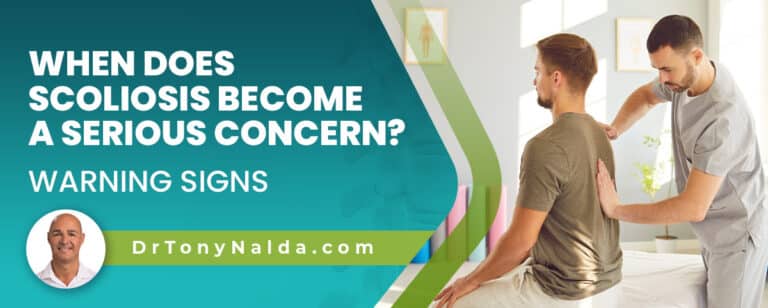 When Does Scoliosis Become a Serious Concern? Warning Signs