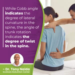 What Can a Scoliosis X Ray Reveal About the Condition?