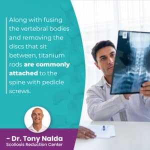 Titanium Rods in Scoliosis Surgery: Benefits and Risks